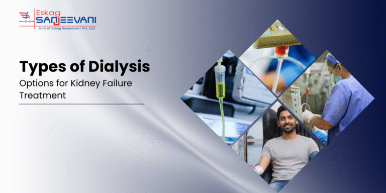 Types of Dialysis: Treatments for Kidney Disease | Eskag Sanjeevani ...