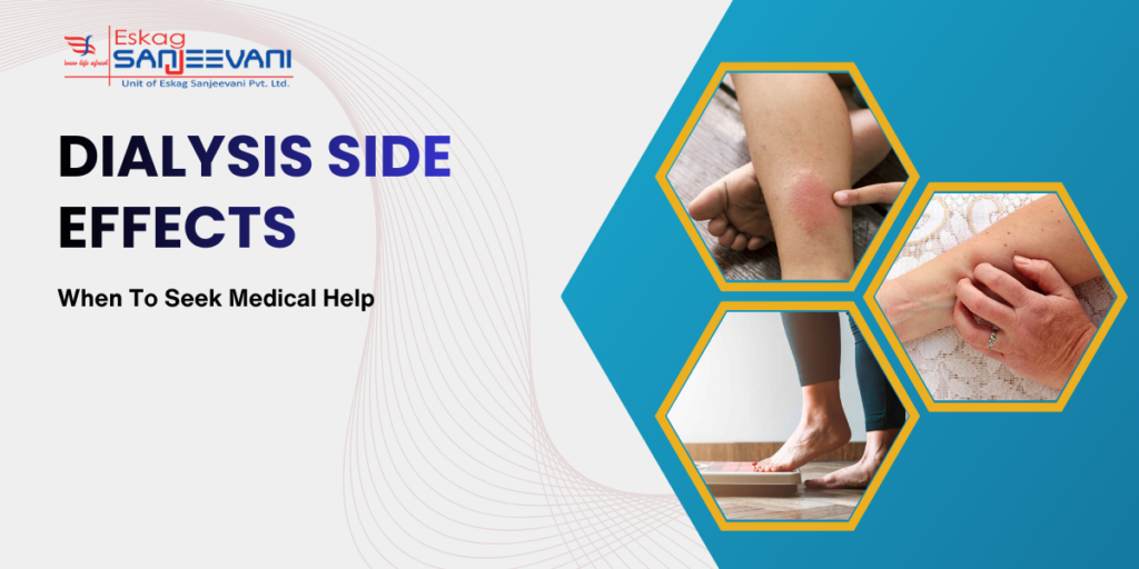 Dialysis Side Effects Explained | Symptoms You Must Know | Eskag ...