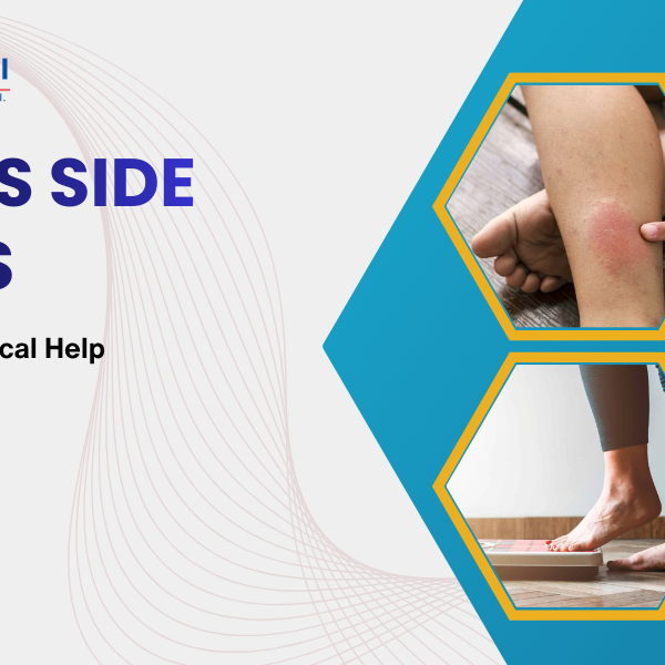 SLED Dialysis Explained: Benefits, Procedure & Indications | Eskag ...