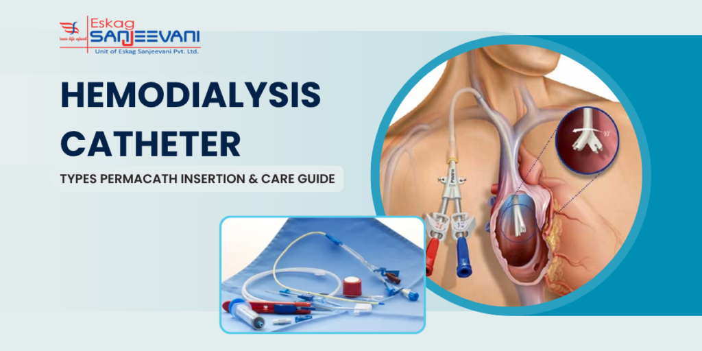 Hemodialysis Catheter | Types, Permacath Insertion & Care